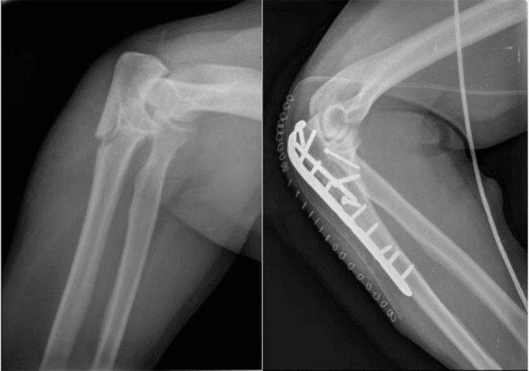 Coude - Docteur Lino